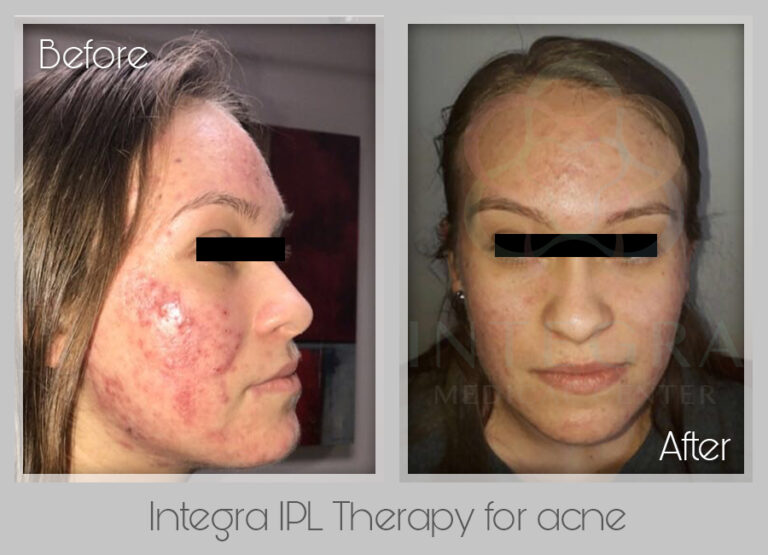 Cosmetic Surgery in Mexico – Integra Medical Center