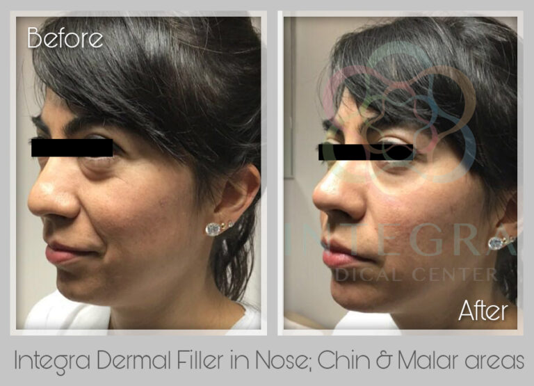 Cosmetic Surgery in Mexico – Integra Medical Center