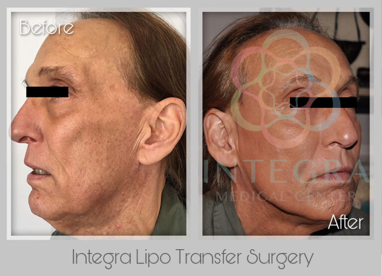 Cosmetic Surgery in Mexico – Integra Medical Center