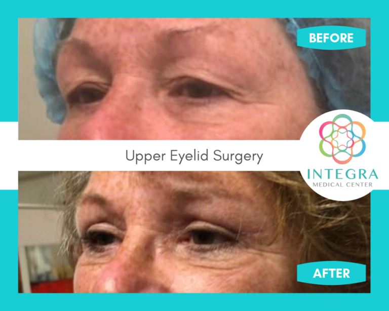 Cosmetic Surgery in Mexico – Integra Medical Center