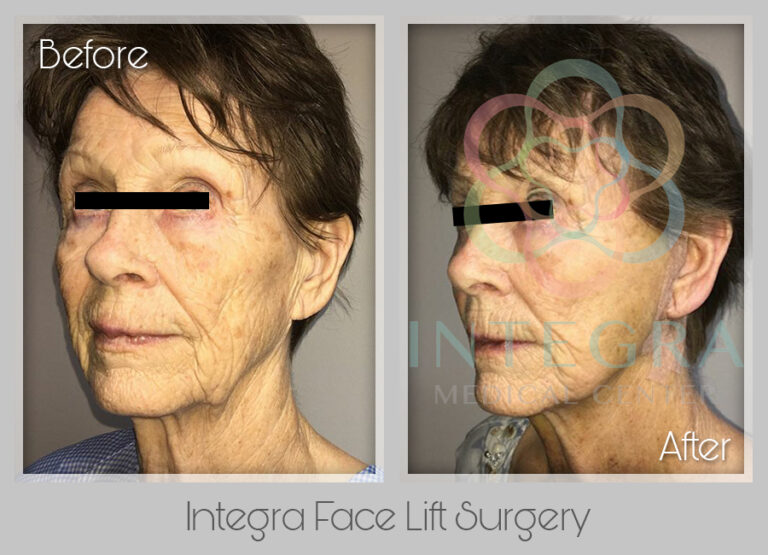Cosmetic Surgery in Mexico – Integra Medical Center